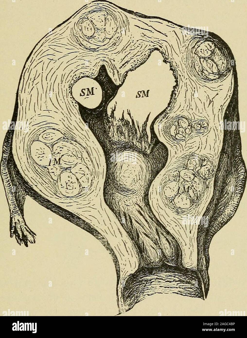 Curettage hi-res stock photography and images - Alamy