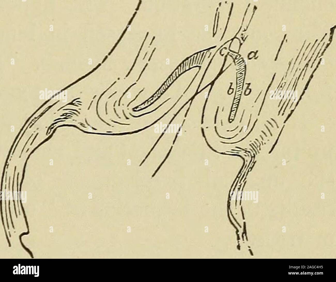 Cervical incision hi-res stock photography and images - Alamy