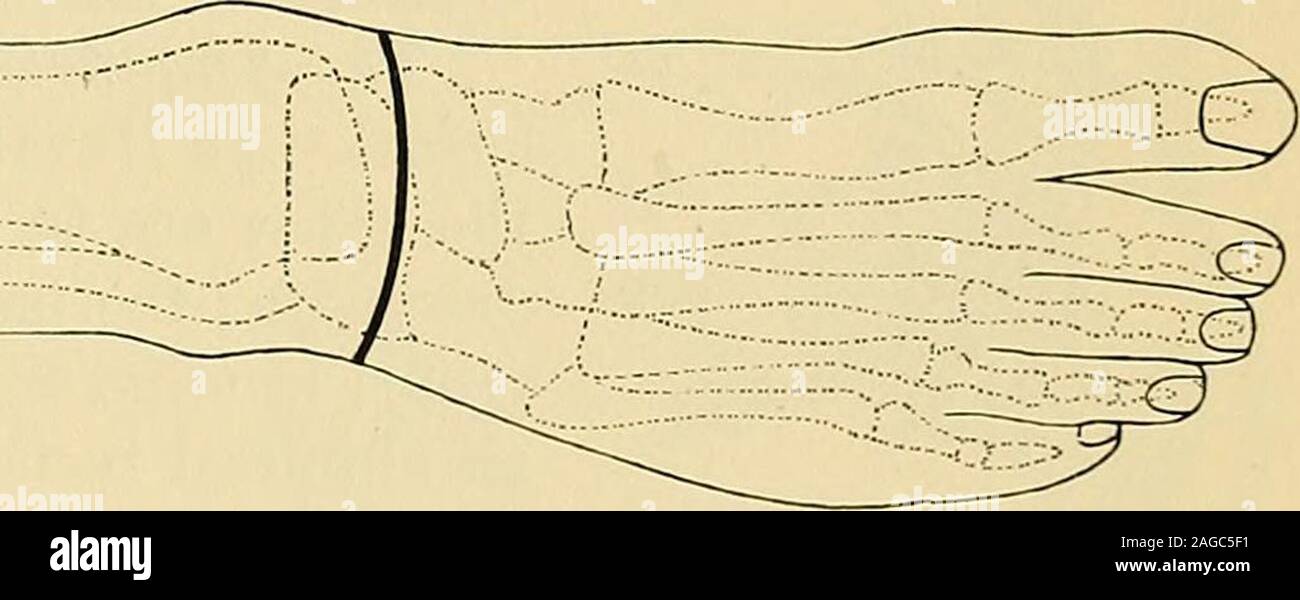 Foot dorsal bones hi-res stock photography and images - Alamy