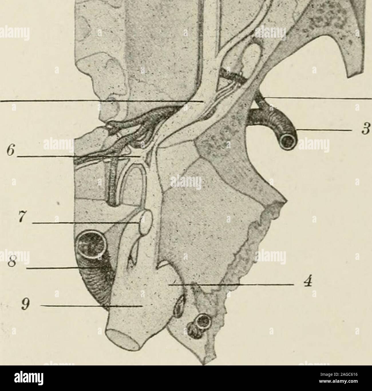 . Local and regional anesthesia; with chapters on spinal, epidural ...