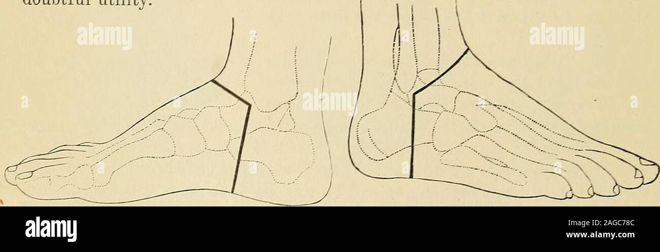 Calcis hi-res stock photography and images - Alamy