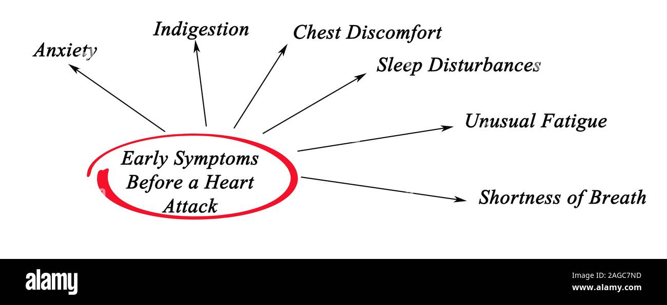 Early Symptoms Before a Heart Attack Stock Photo - Alamy