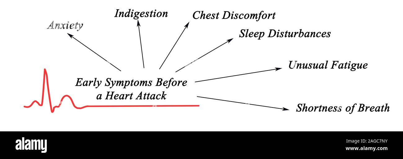 Early Symptoms Before a Heart Attack Stock Photo - Alamy