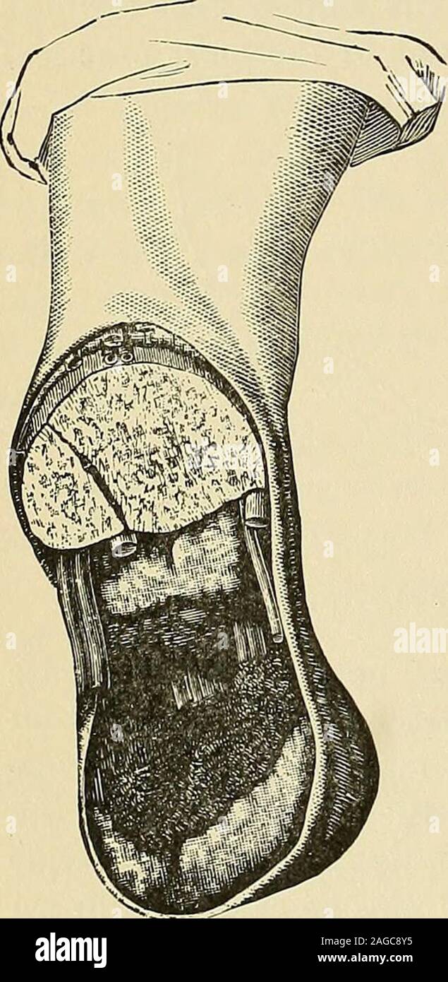 . Operative surgery. Fig. 589.—Bones of leg sawn through Stock Photo ...