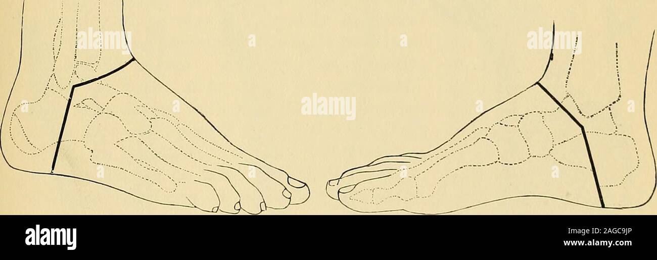 Calcis hi-res stock photography and images - Alamy