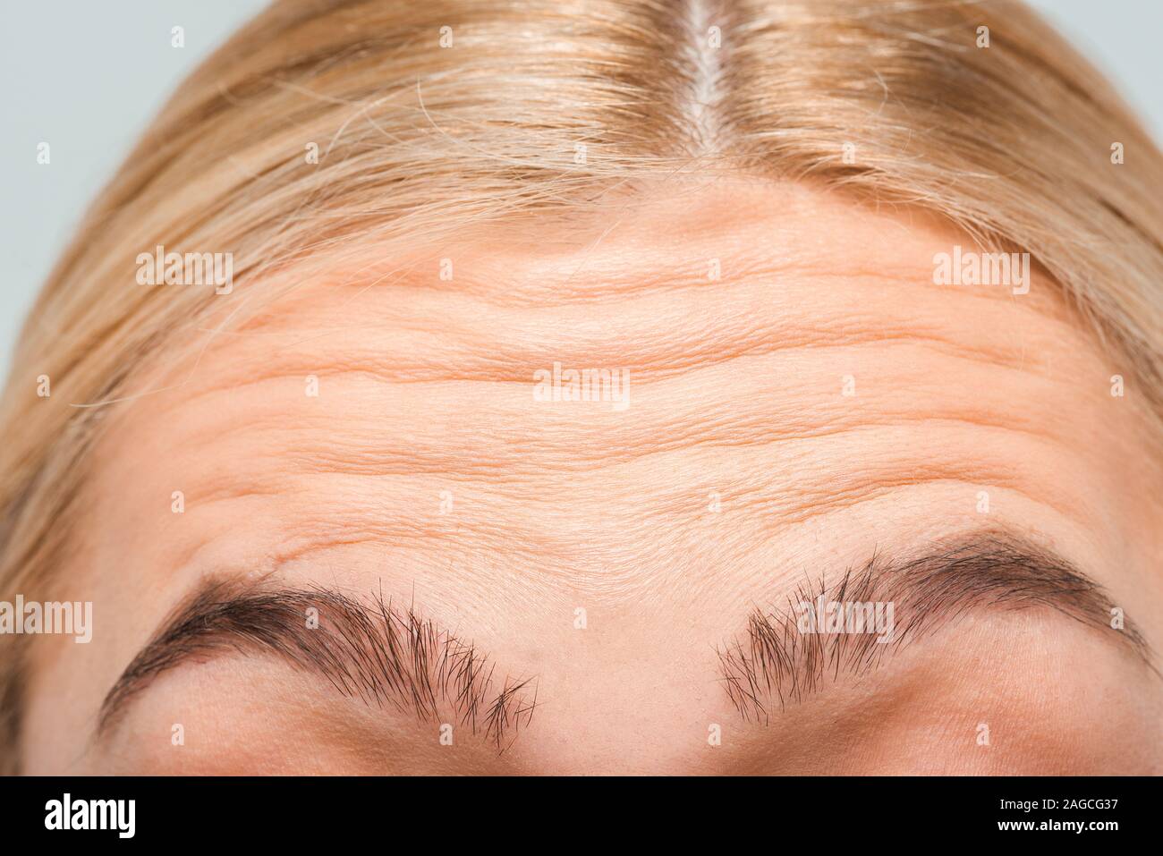 Wrinkled forehead hi-res stock photography and images - Alamy