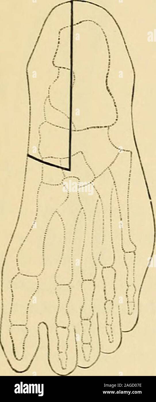 Dorsum of foot hi-res stock photography and images - Alamy