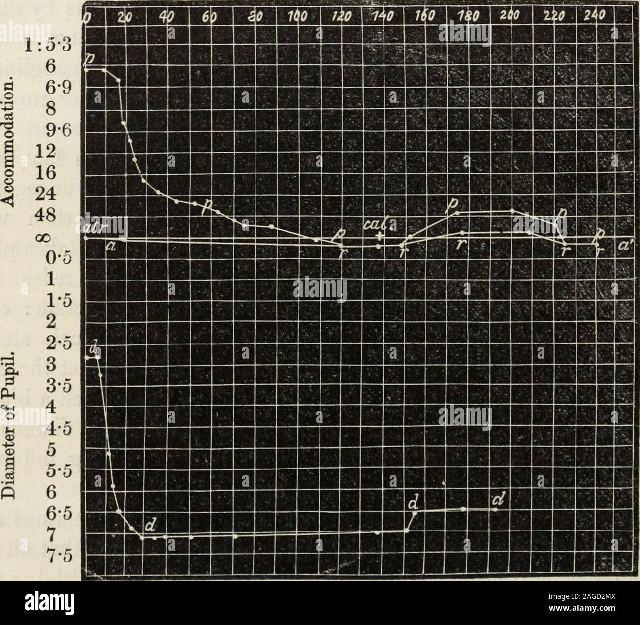 Spasm of accommodation hi-res stock photography and images - Alamy