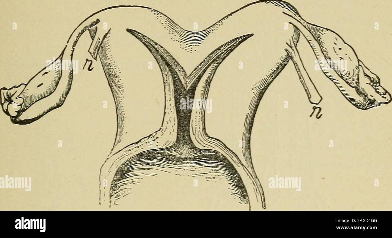 Round ligament of uterus hi-res stock photography and images - Alamy