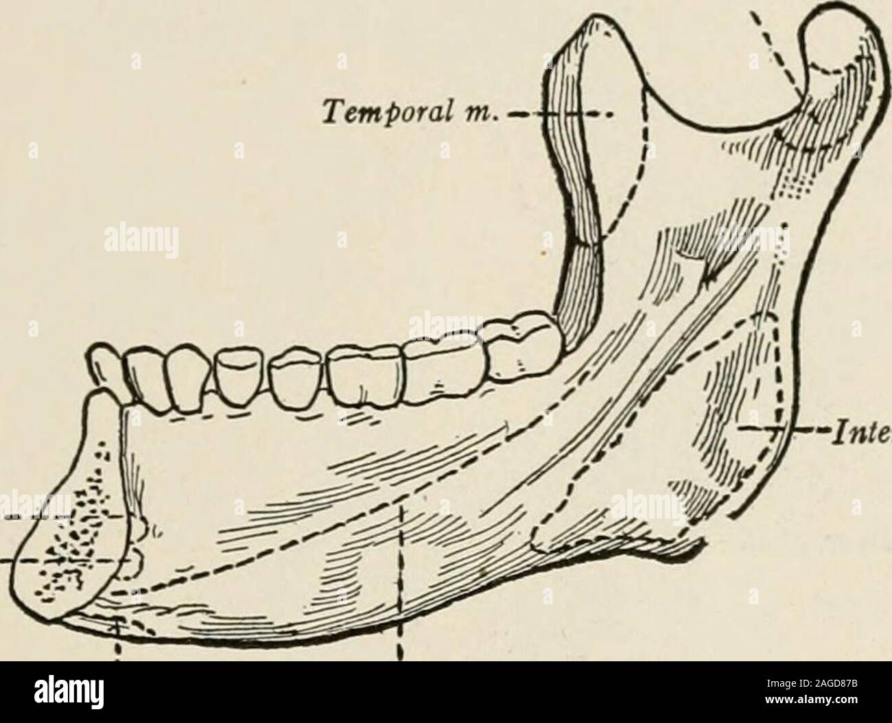 . Local and regional anesthesia; with chapters on spinal, epidural ...