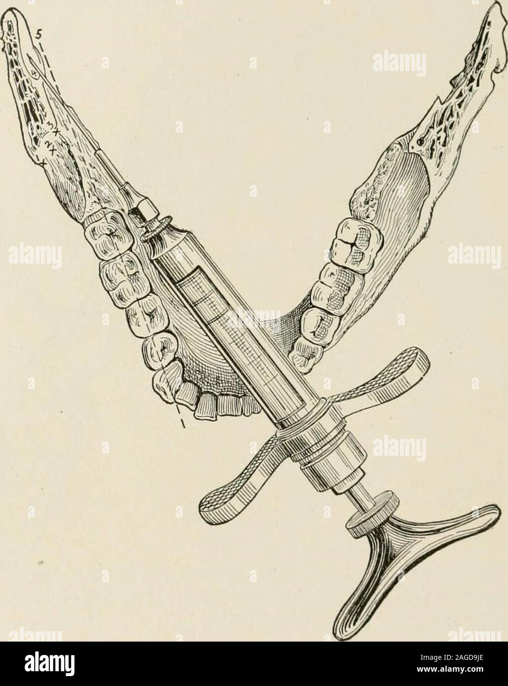 Throat mucosa hi-res stock photography and images - Alamy