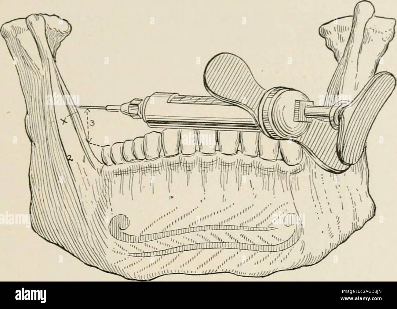 Mylohyoid hi-res stock photography and images - Alamy