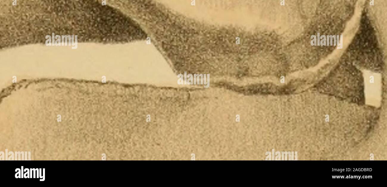 Anatomische hi-res stock photography and images - Alamy