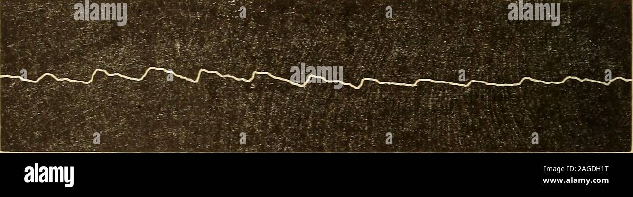 . A text-book on mental diseases, for the use of students and ...