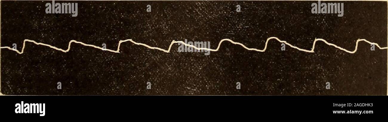 . A text-book on mental diseases, for the use of students and ...