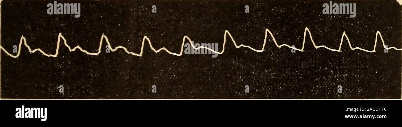 . A text-book on mental diseases, for the use of students and ...