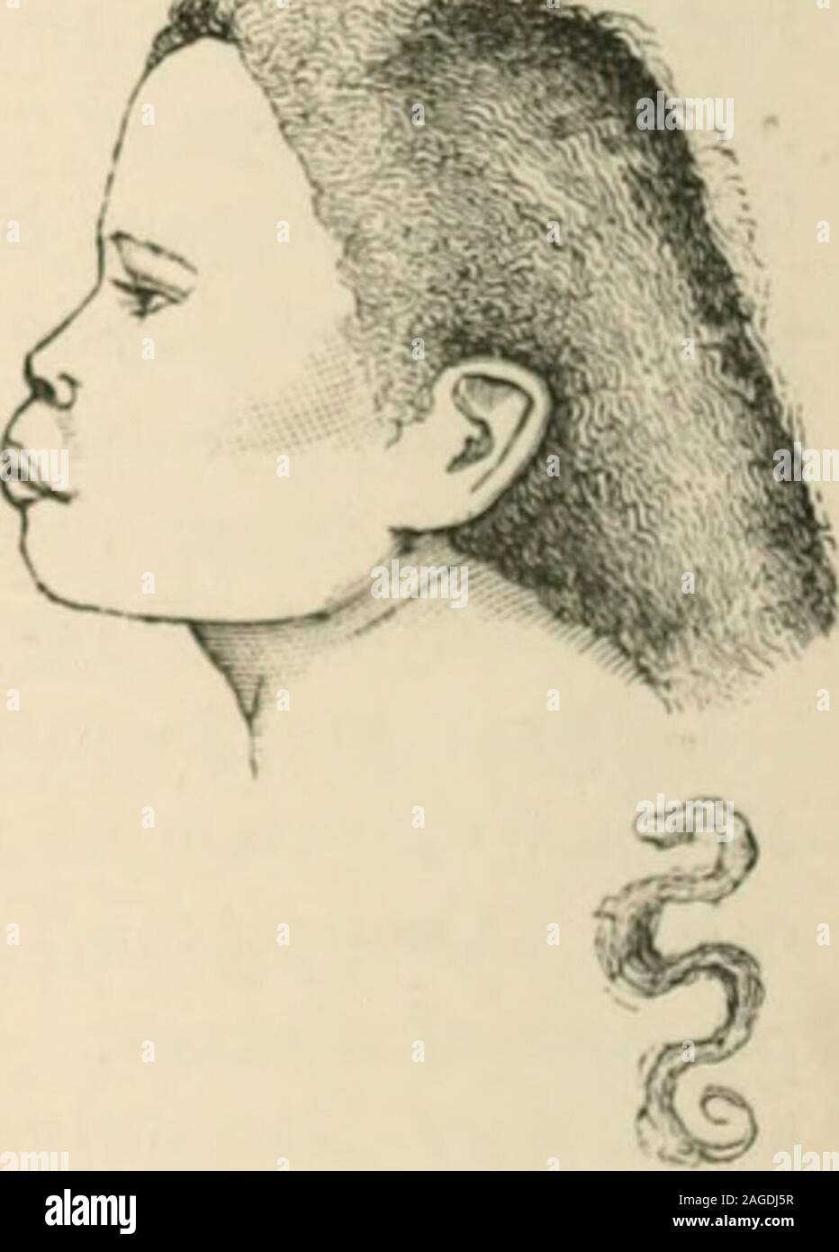 Lank hair hi-res stock photography and images - Alamy