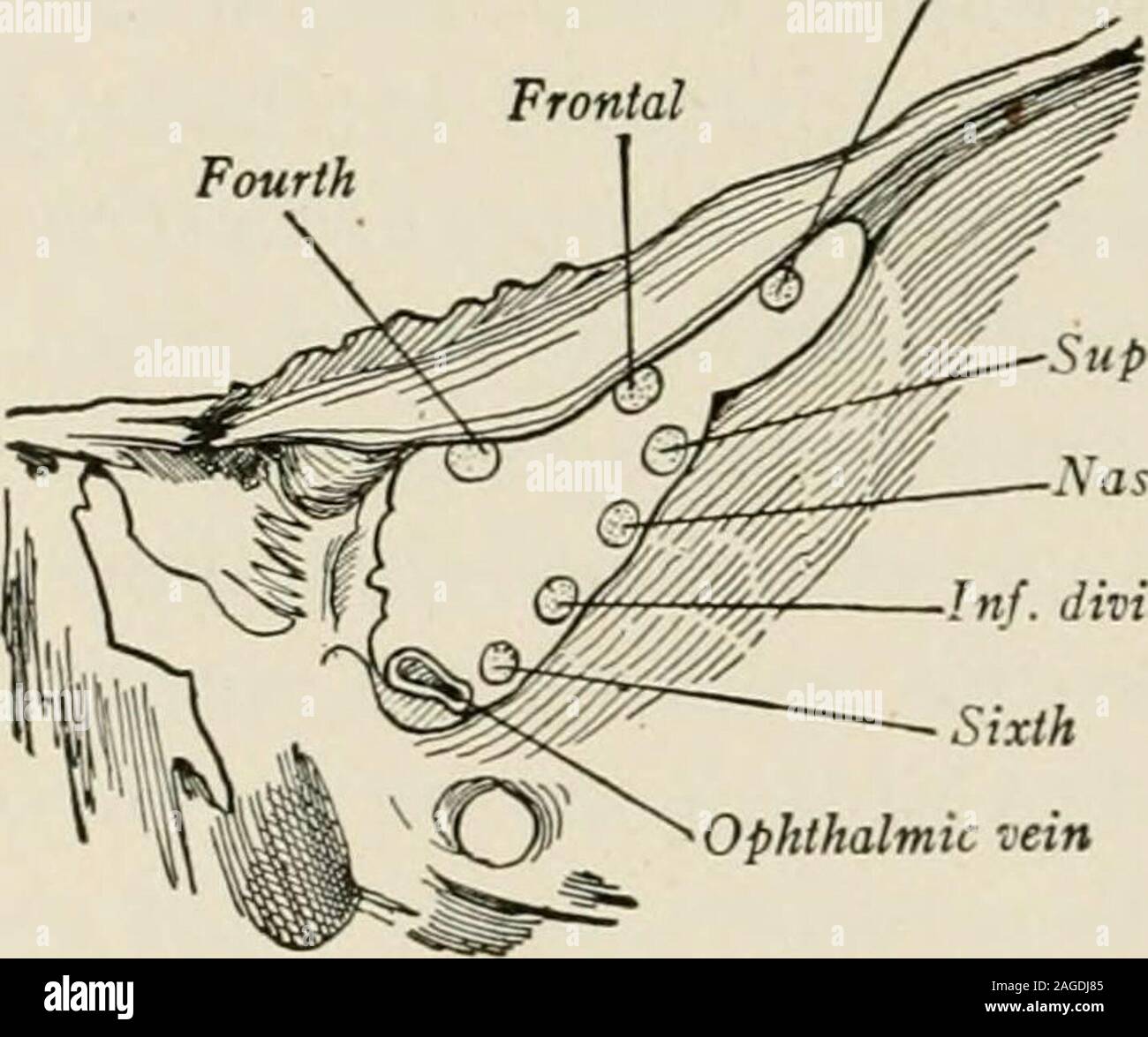 . Local and regional anesthesia; with chapters on spinal, epidural ...