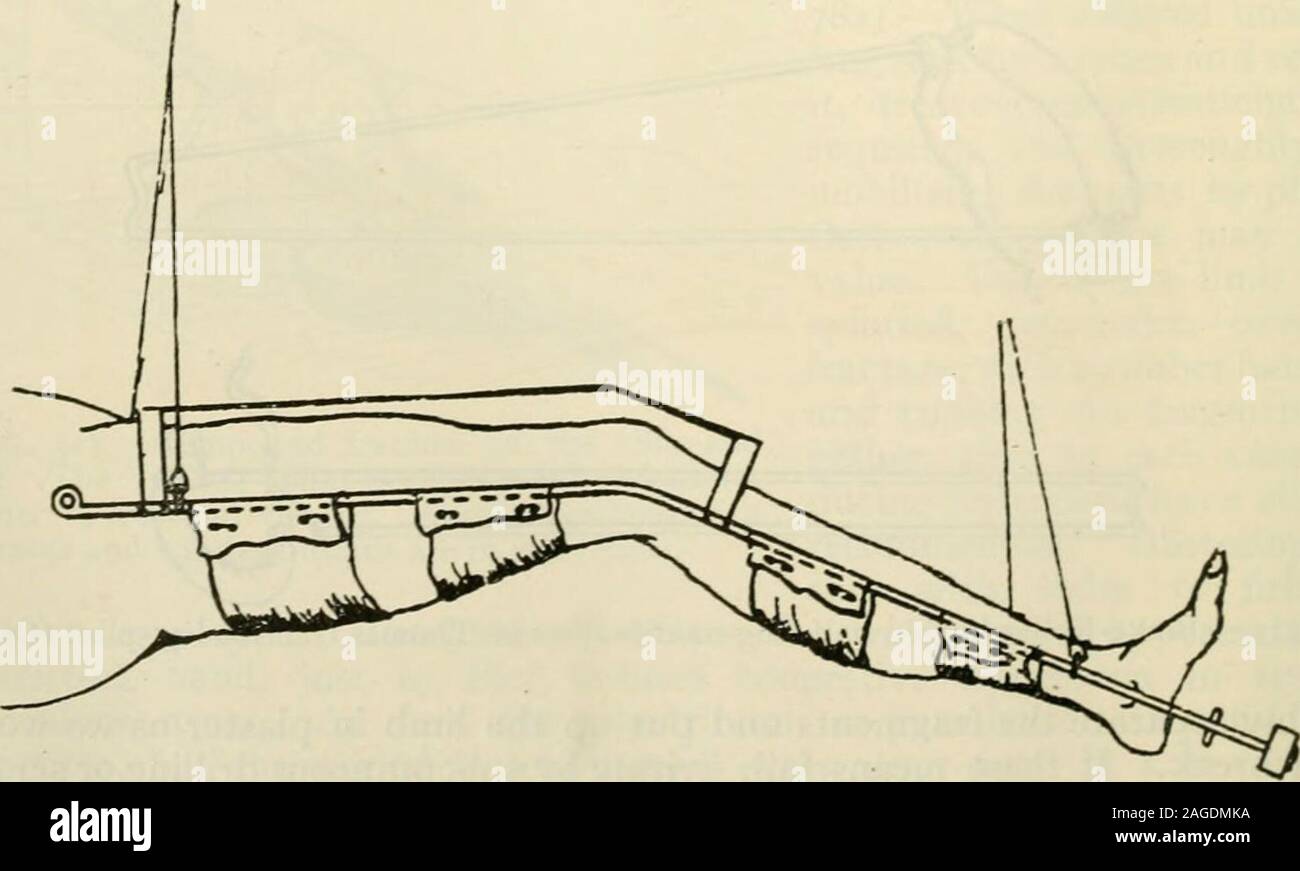 . Modern surgery, general and operative. enHgp d Fig. 324.—Cabot ...