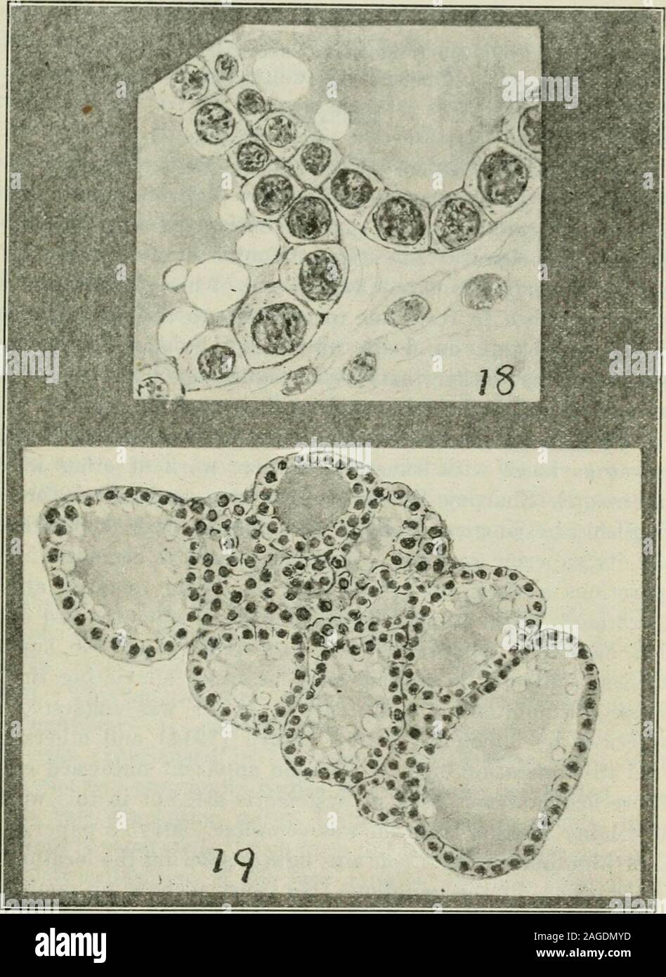 . Endocrinology. PLATE IIIFigure 18. Epithelium from thyroid of ...