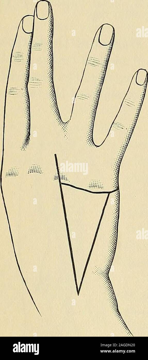 Outer flap hi-res stock photography and images - Alamy