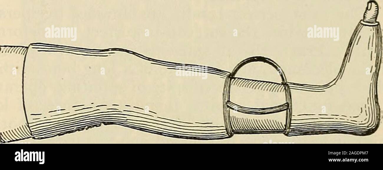 Bone spicule hi-res stock photography and images - Alamy