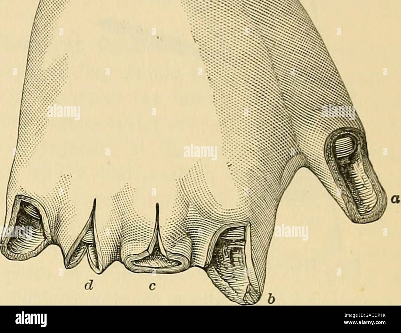 . Operative surgery. Fig. 513.—Appearance of flapat palmar surface. Fig ...