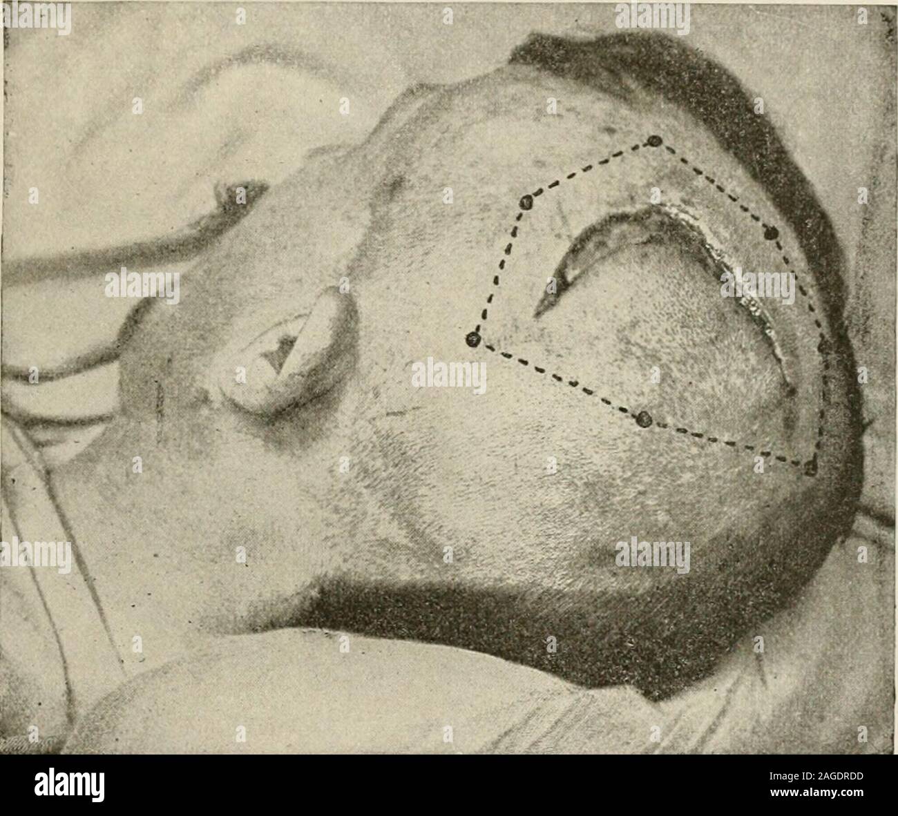 Bone through nose hi-res stock photography and images - Alamy