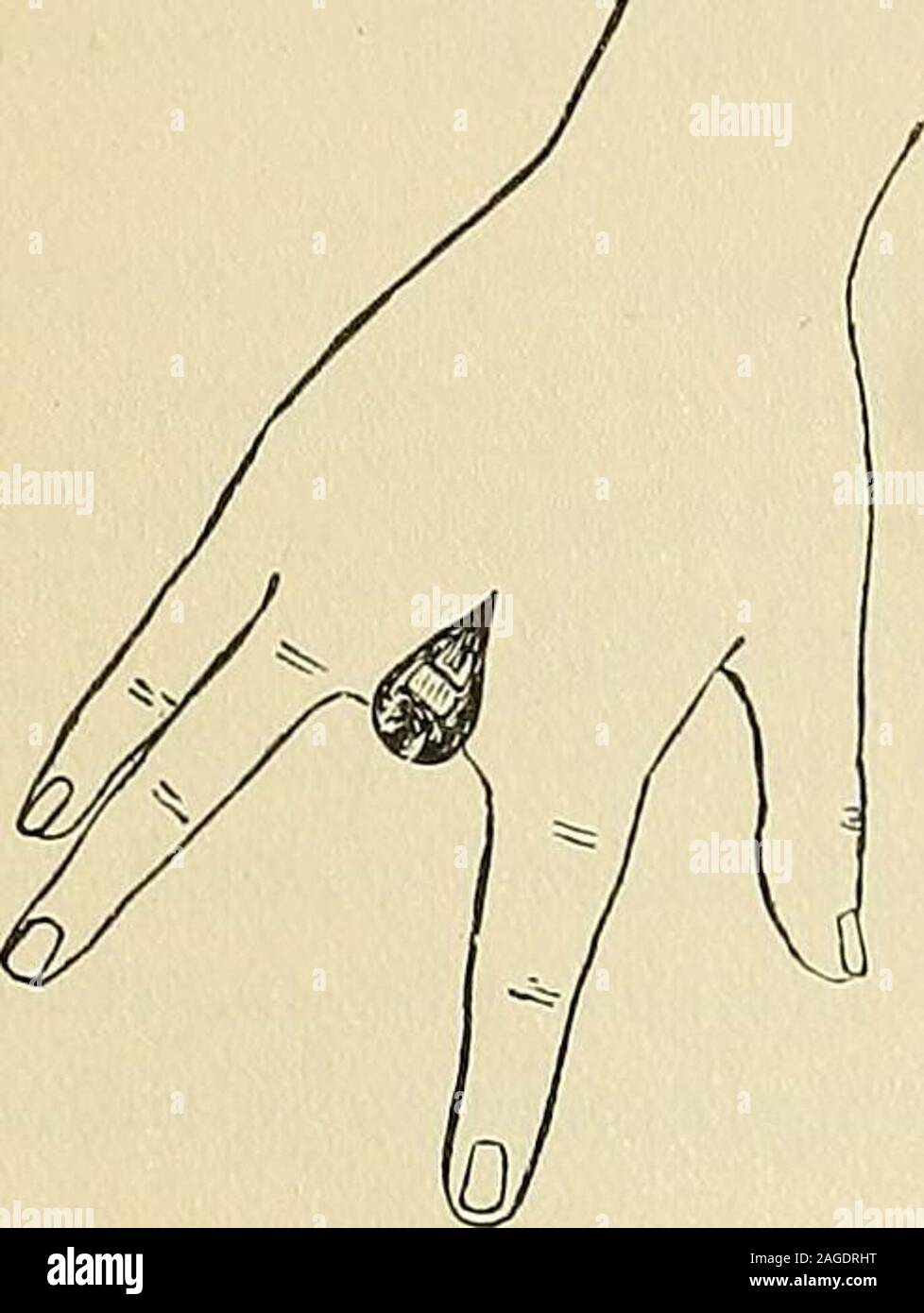 O operative hi-res stock photography and images - Alamy