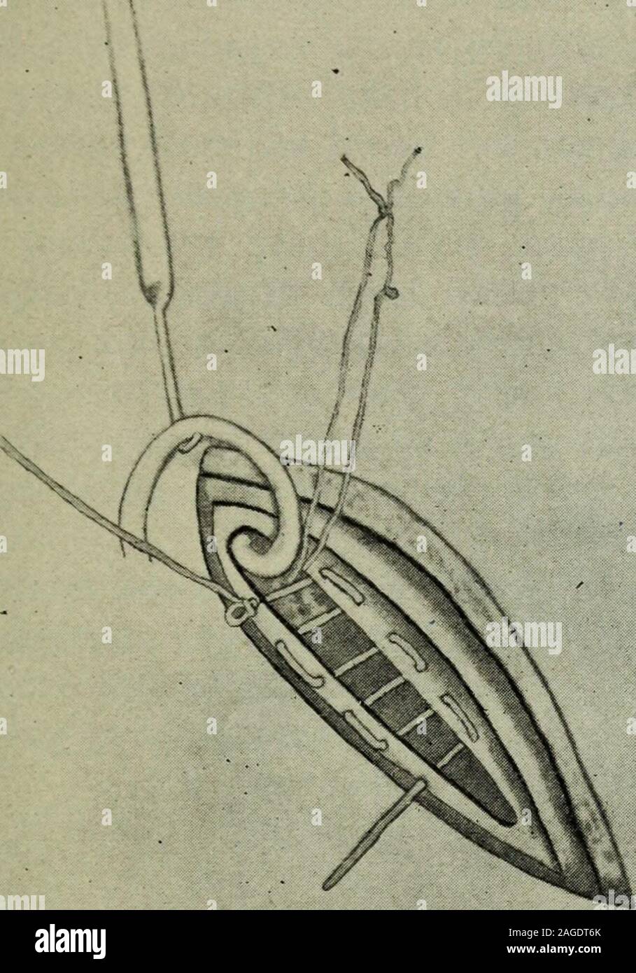 Pouparts ligament hi-res stock photography and images - Alamy
