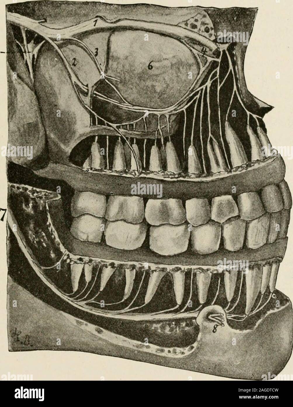 . Local and regional anesthesia; with chapters on spinal, epidural ...
