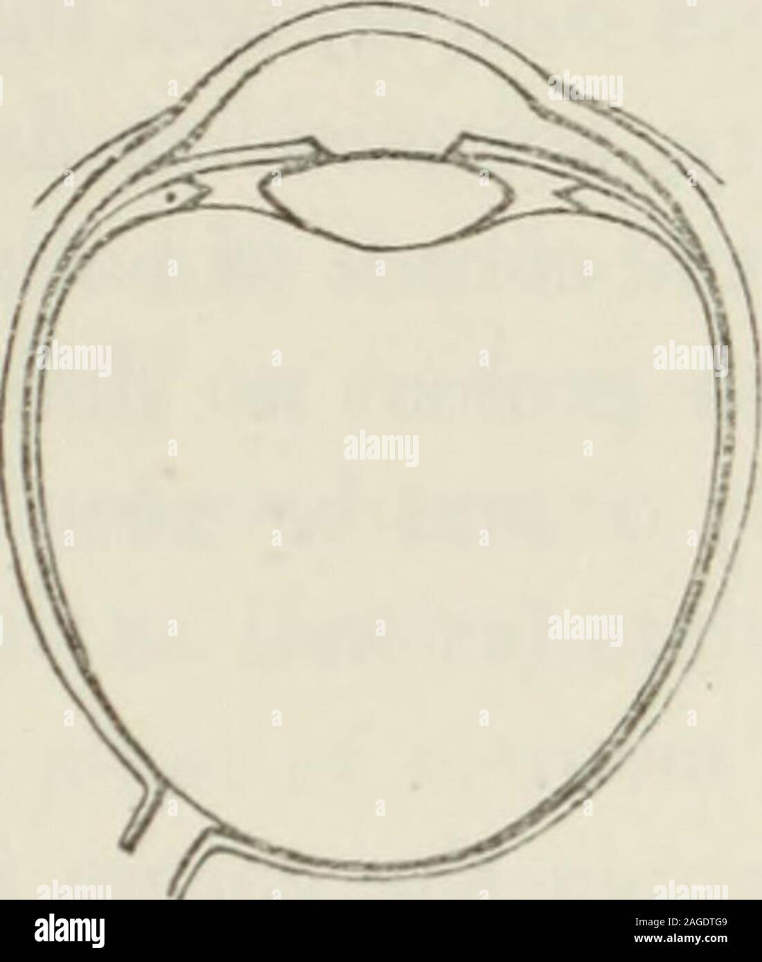 . On the anomalies of accommodation and refraction of the eye, witha ...