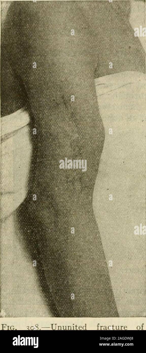 Heal the wound of loss hi-res stock photography and images - Alamy