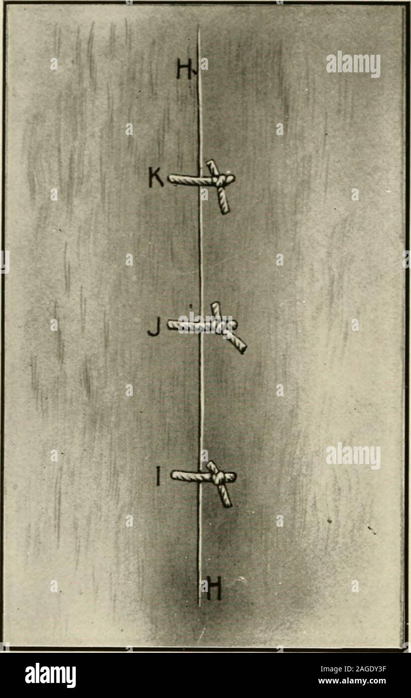 Sutured skin hi-res stock photography and images - Alamy
