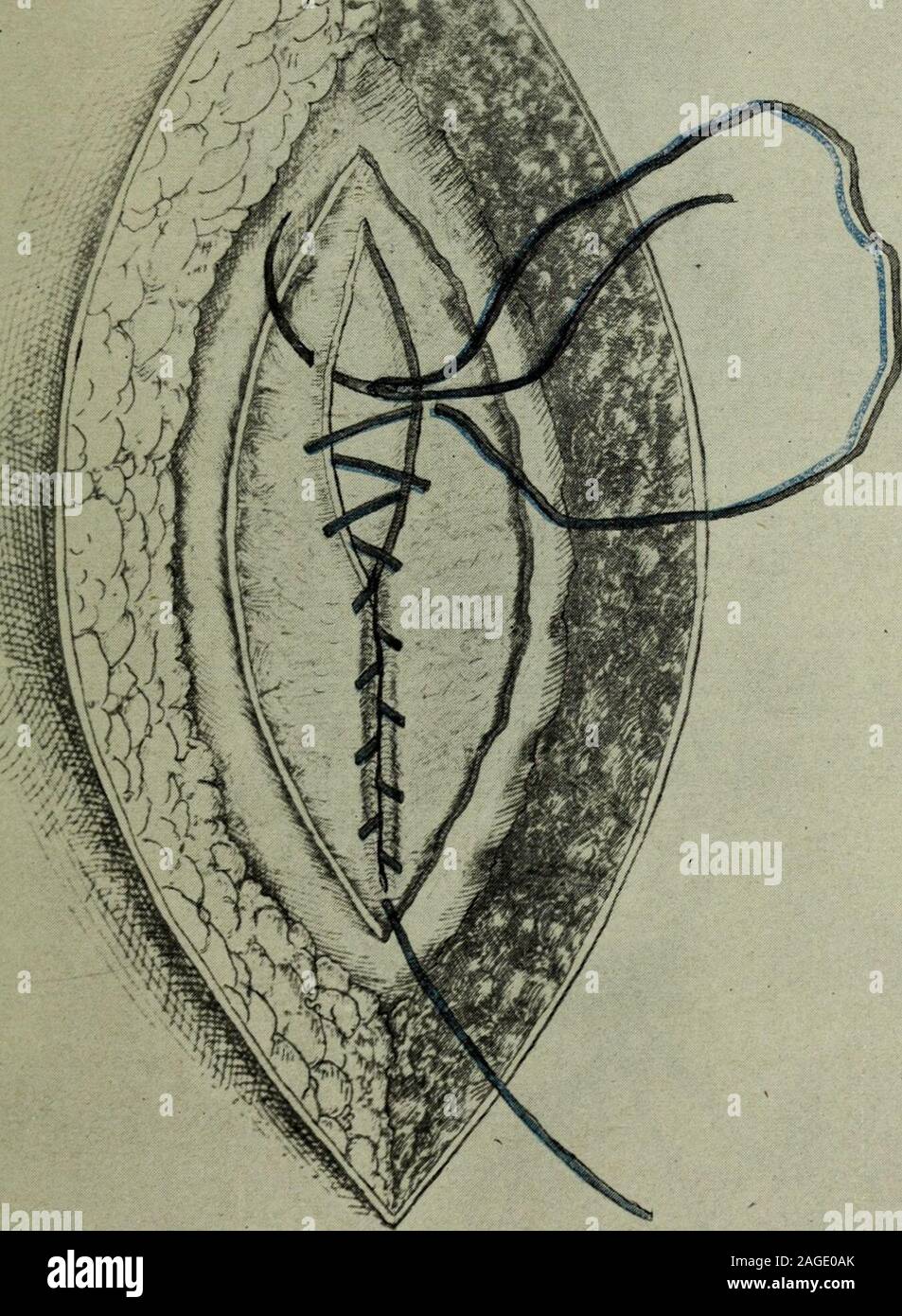 . Plexus. e abdominalwall by elevation of the thighs and shoulders; one ...