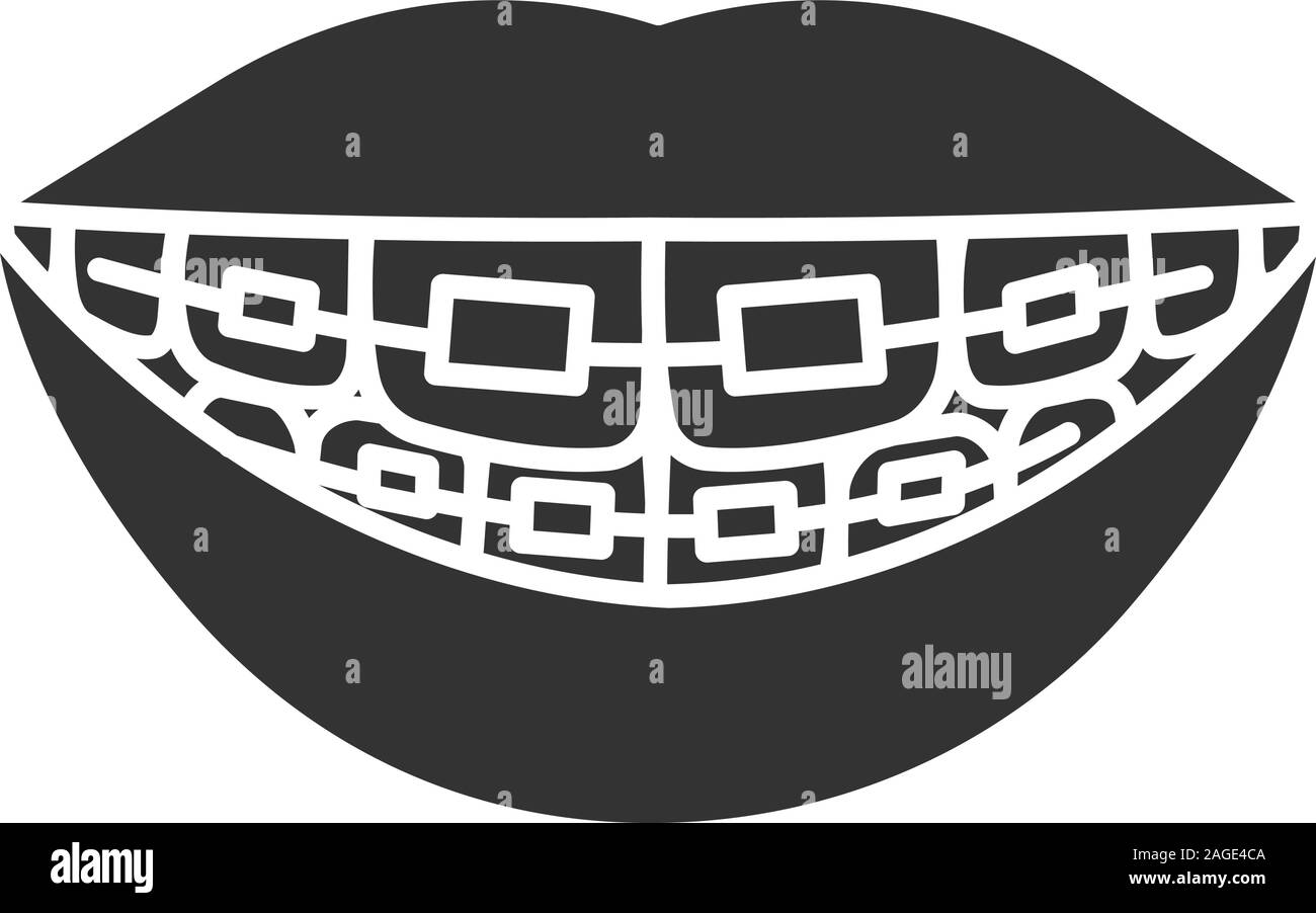 Dental braces glyph icon. Teeth aligning. Silhouette symbol. Negative ...
