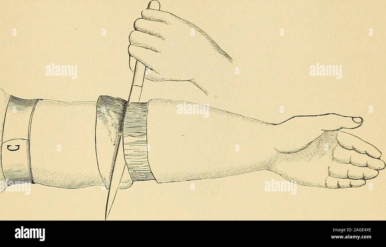 Inturning hi-res stock photography and images - Alamy