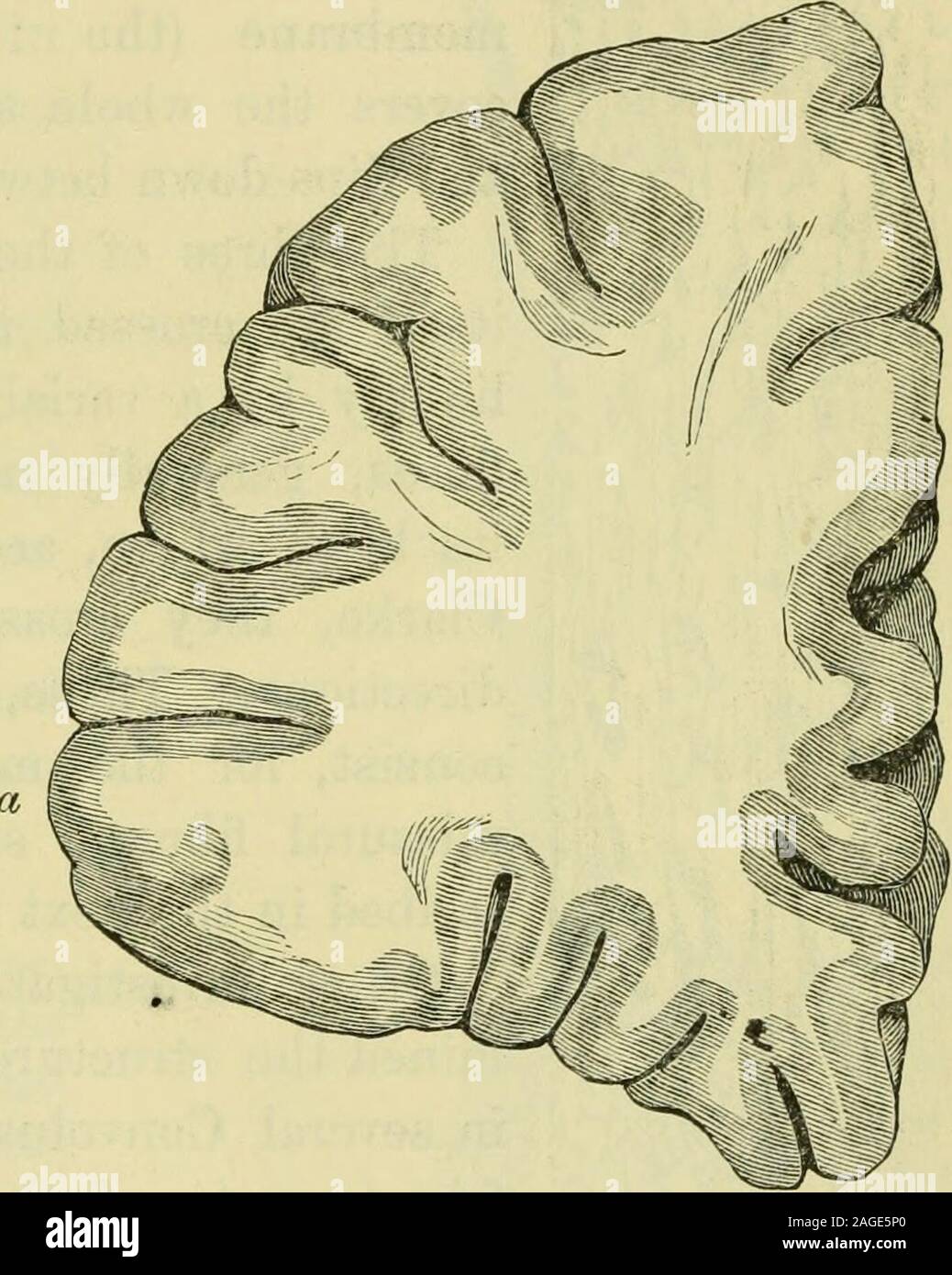 Anterior frontal lobe brain hi-res stock photography and images - Alamy