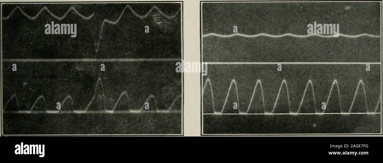 Limit of disturbance hi-res stock photography and images - Alamy