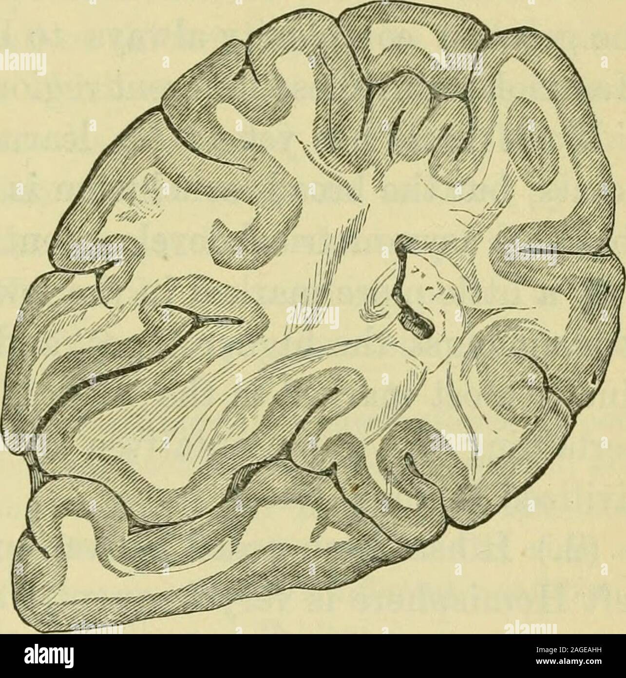 Surfaces in mind hi-res stock photography and images - Alamy