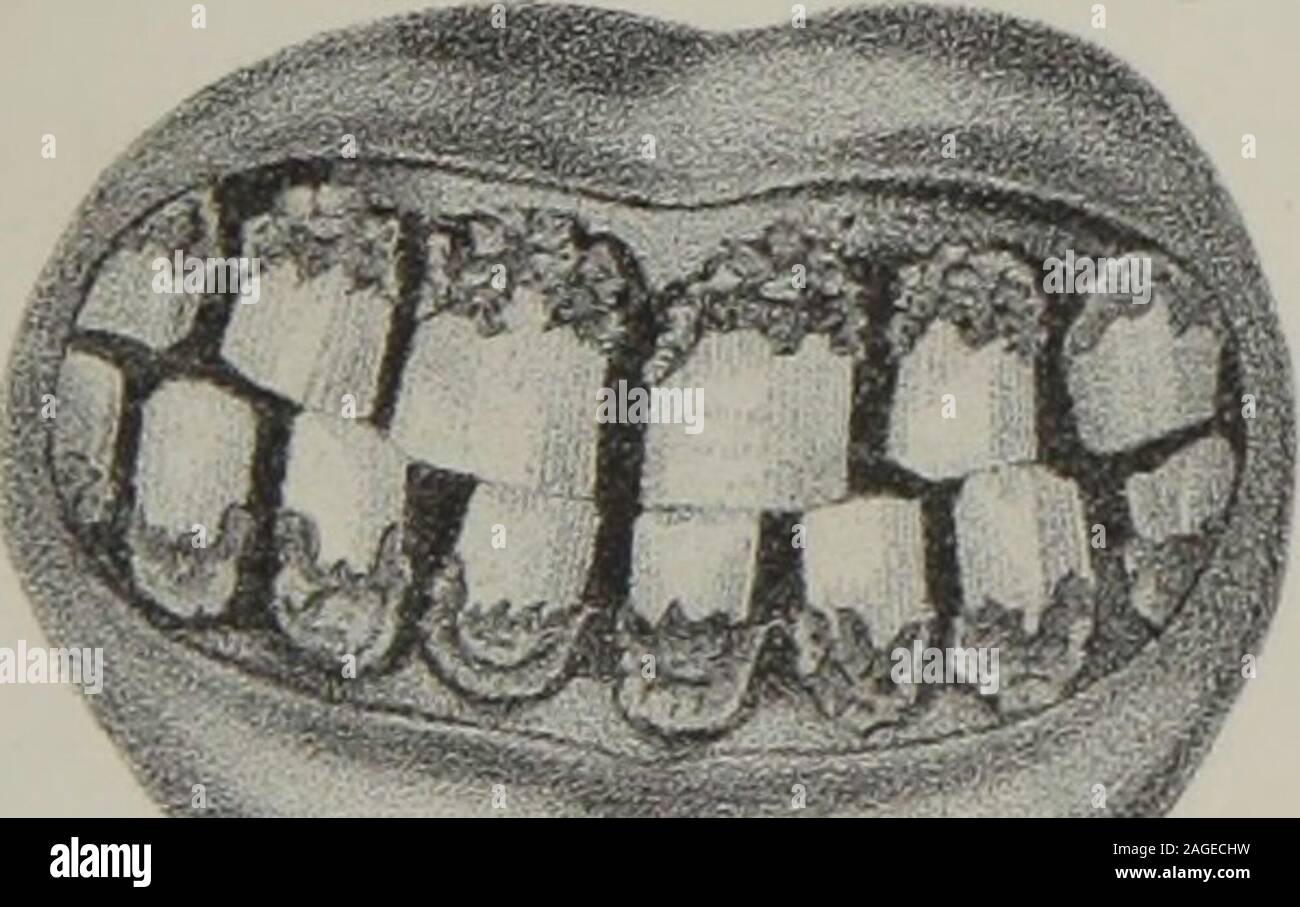 . The anatomy, physiology and pathology of the human teeth : with the ...