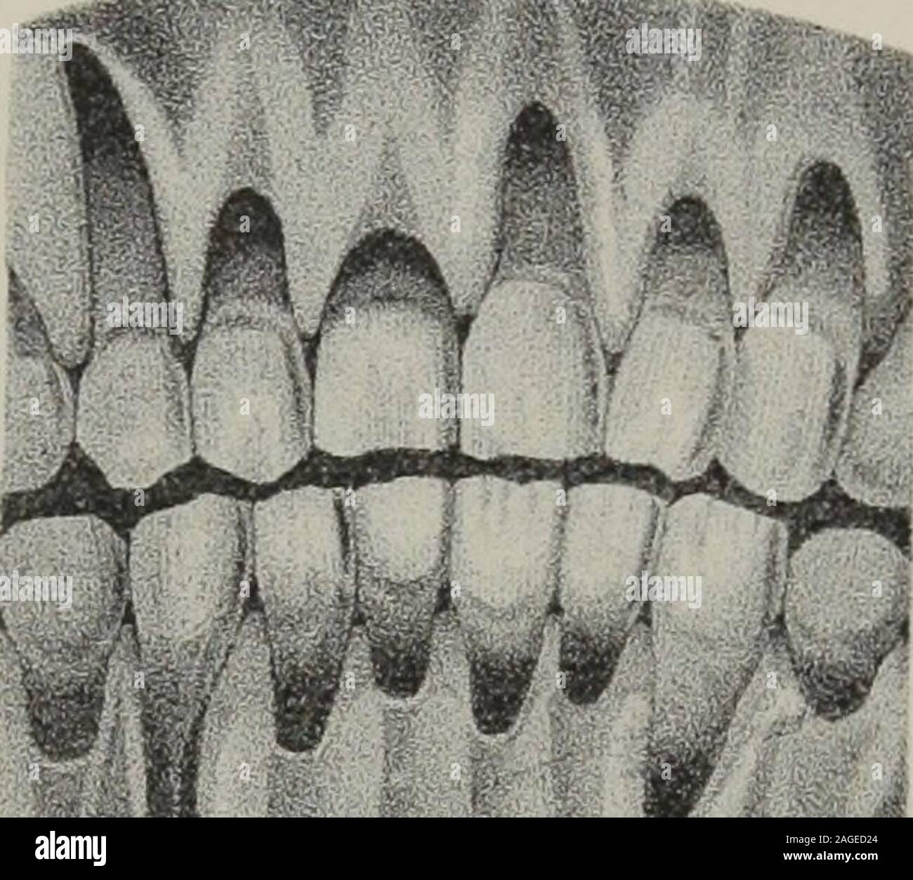 . The anatomy, physiology and pathology of the human teeth : with the ...