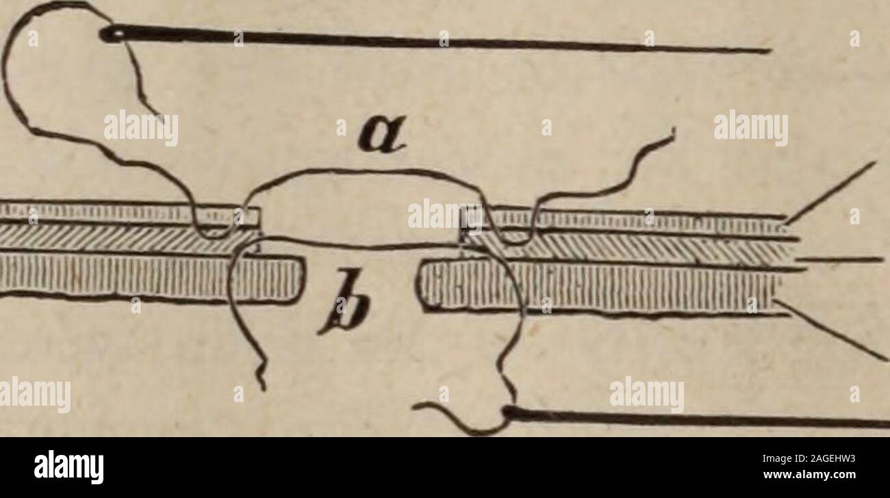 . Daniel's Texas medical journal. he work of stitching the ends of the ...