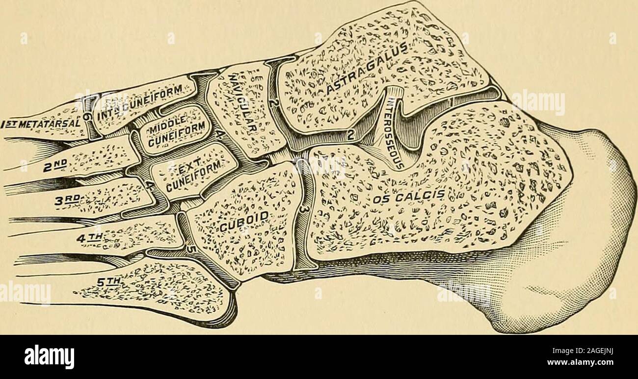 . Operative surgery. Fig. 422.. -Lines of incision for removal of head ...