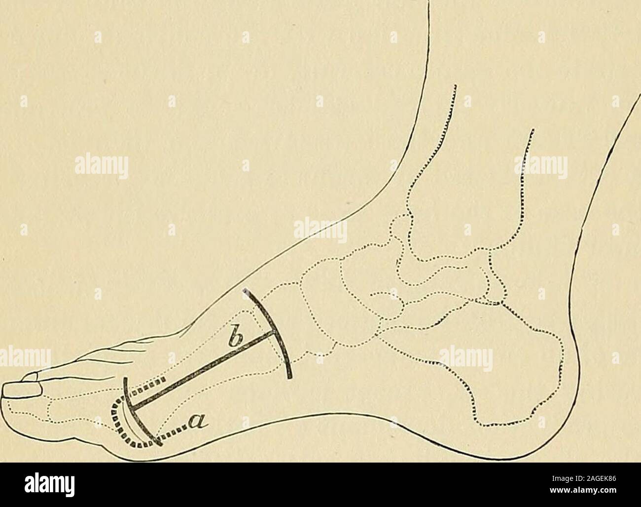 . Operative surgery. reated likewise. The RemarJcs.—This joint of the ...