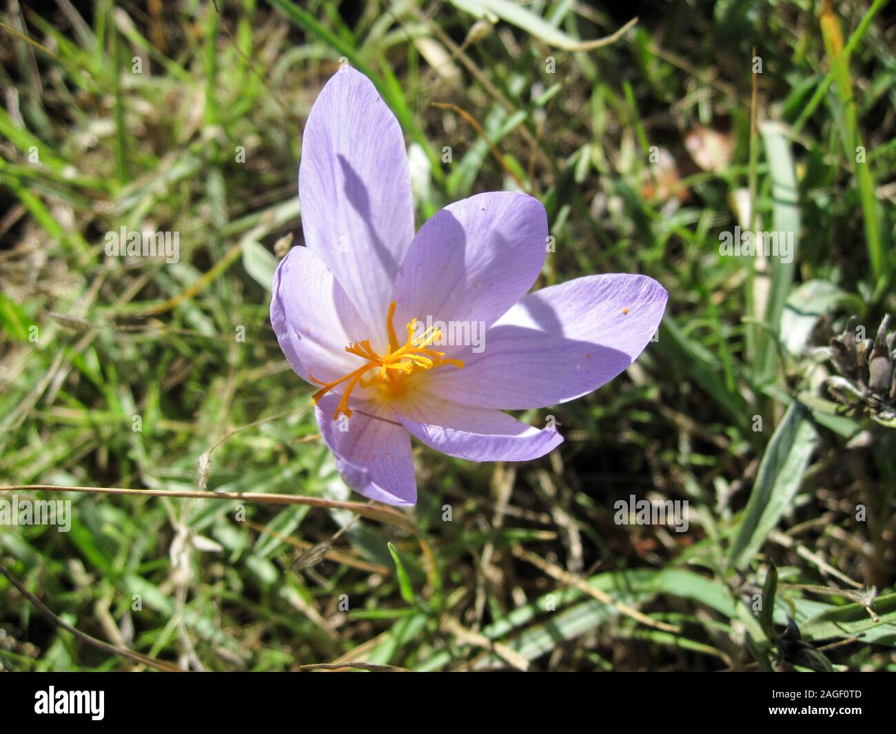 Iris scars hi-res stock photography and images - Alamy