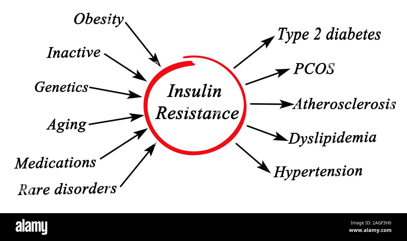 Insulin resistance hi-res stock photography and images - Alamy