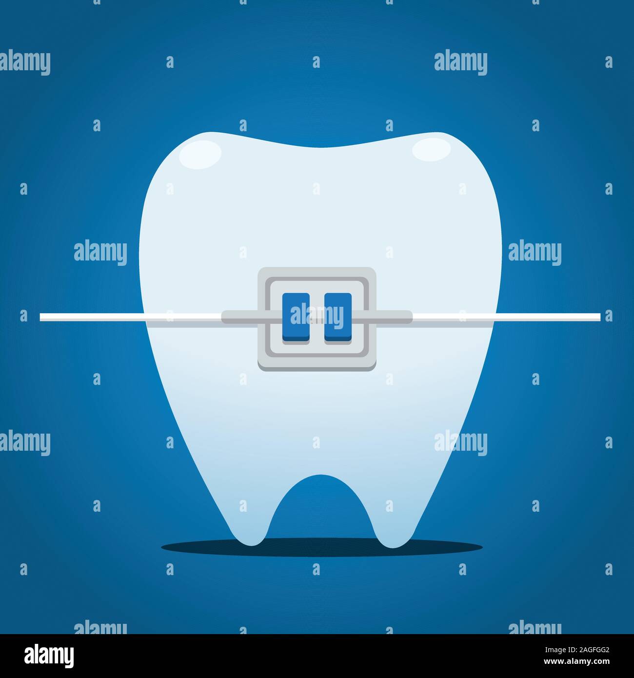 tooth with metal braces. Isolated Vector Illustration Stock Vector ...