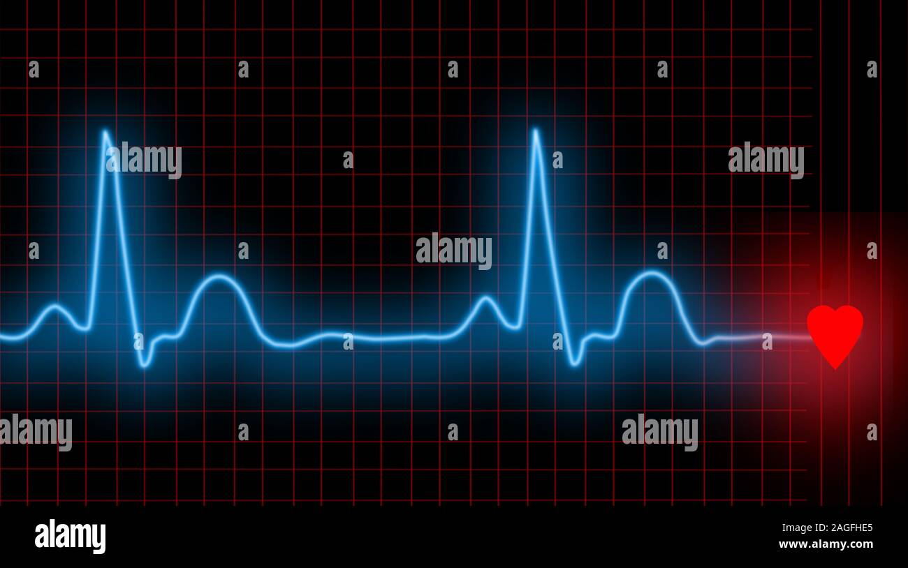 Ecg Graph Stock Photos & Ecg Graph Stock Images - Alamy