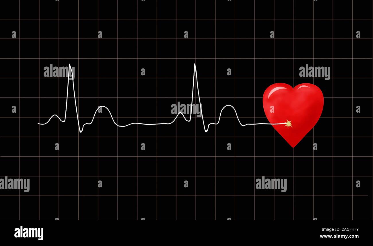 ECG graph Stock Photo - Alamy